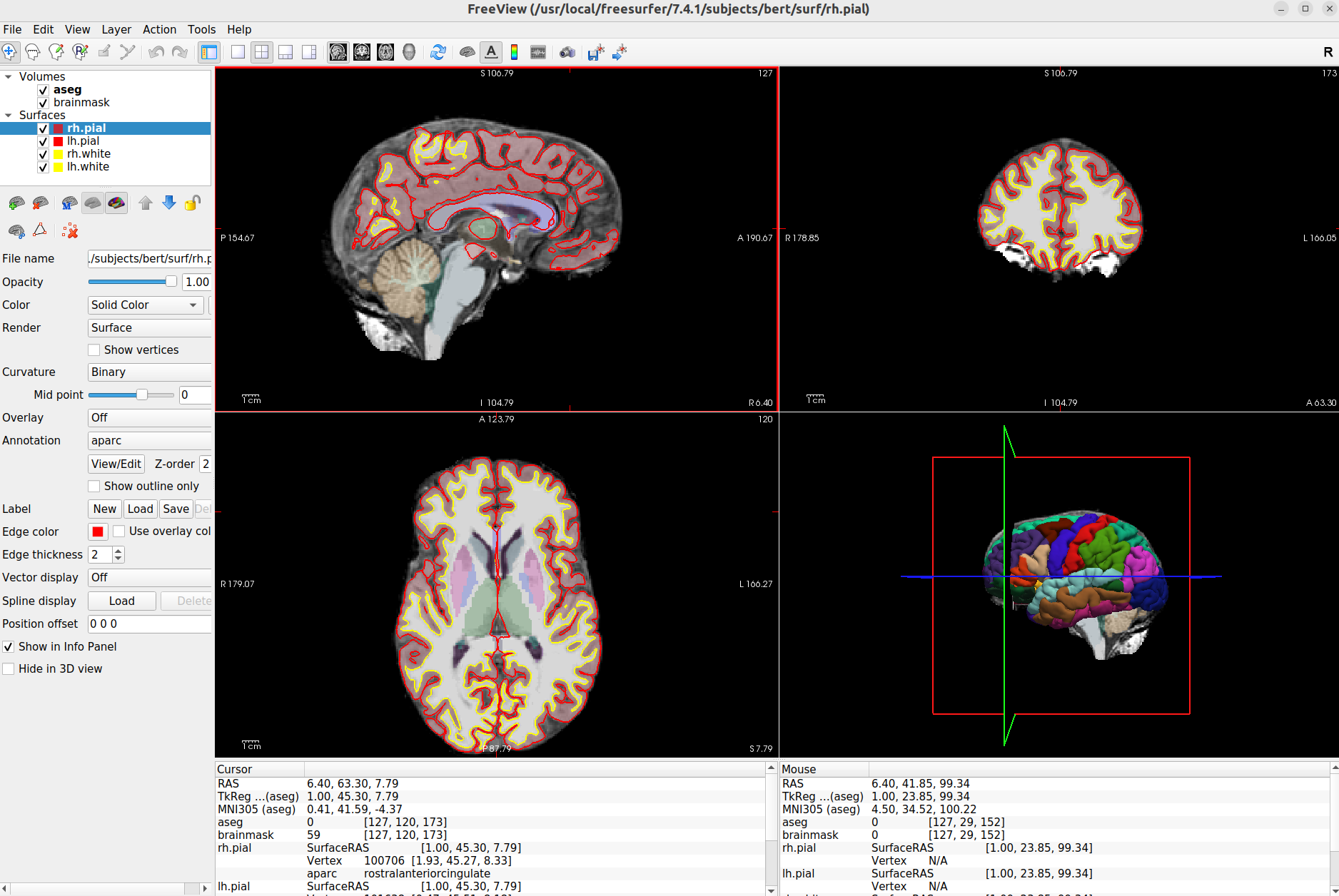 Tooling for image segmentation | Tech/Data stuff